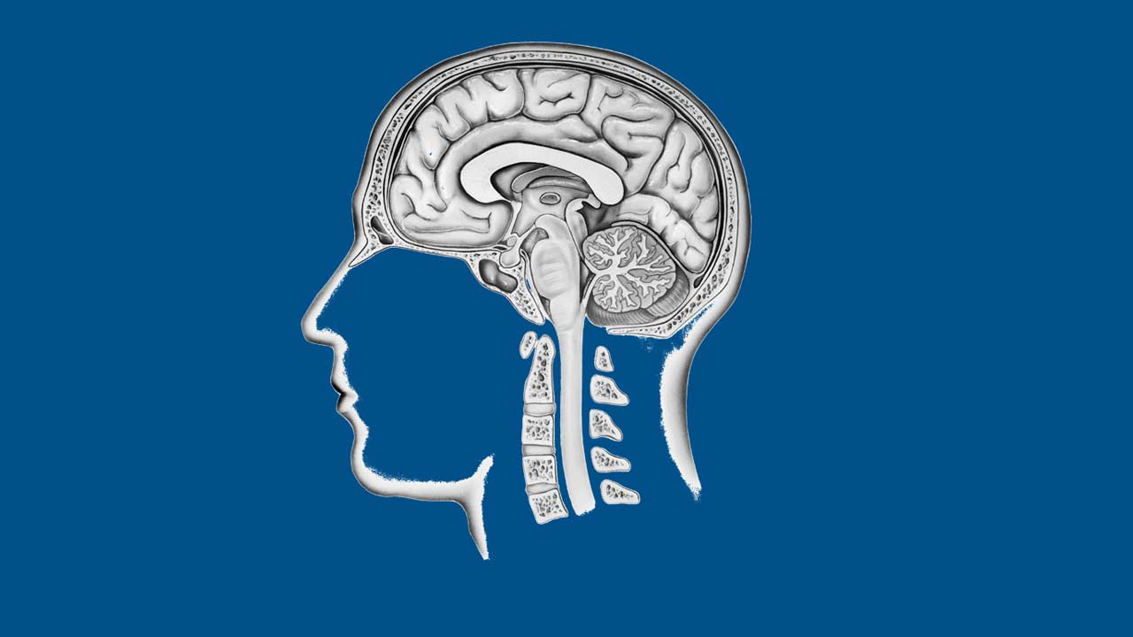 Chiari Malformation :: New York Brain, Spine & Joint